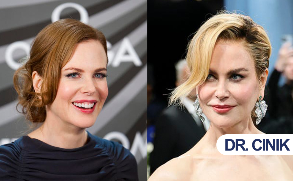 Nicola Kidman Plastic Surgery - DR. CINIK